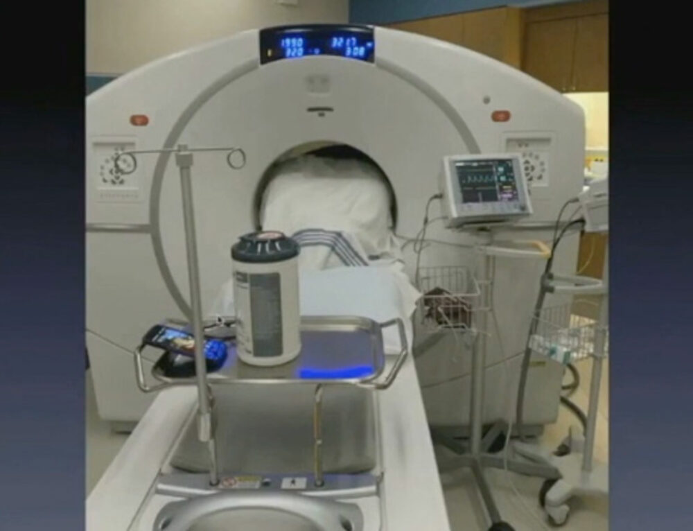 Cardiac N-13 Ammonia Can Resolve Equivocal Soft Tissue Attenuation ...